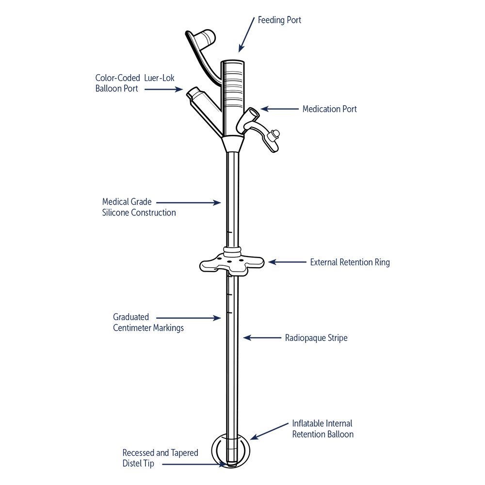 Feeding Tube Parts Polymed Gastro Duodenal Gastrostomy Feeding Tube
